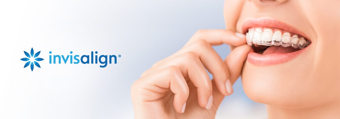 Invisalign St Albans - Teeth Straightening - Russell Avenue Dental Clinic